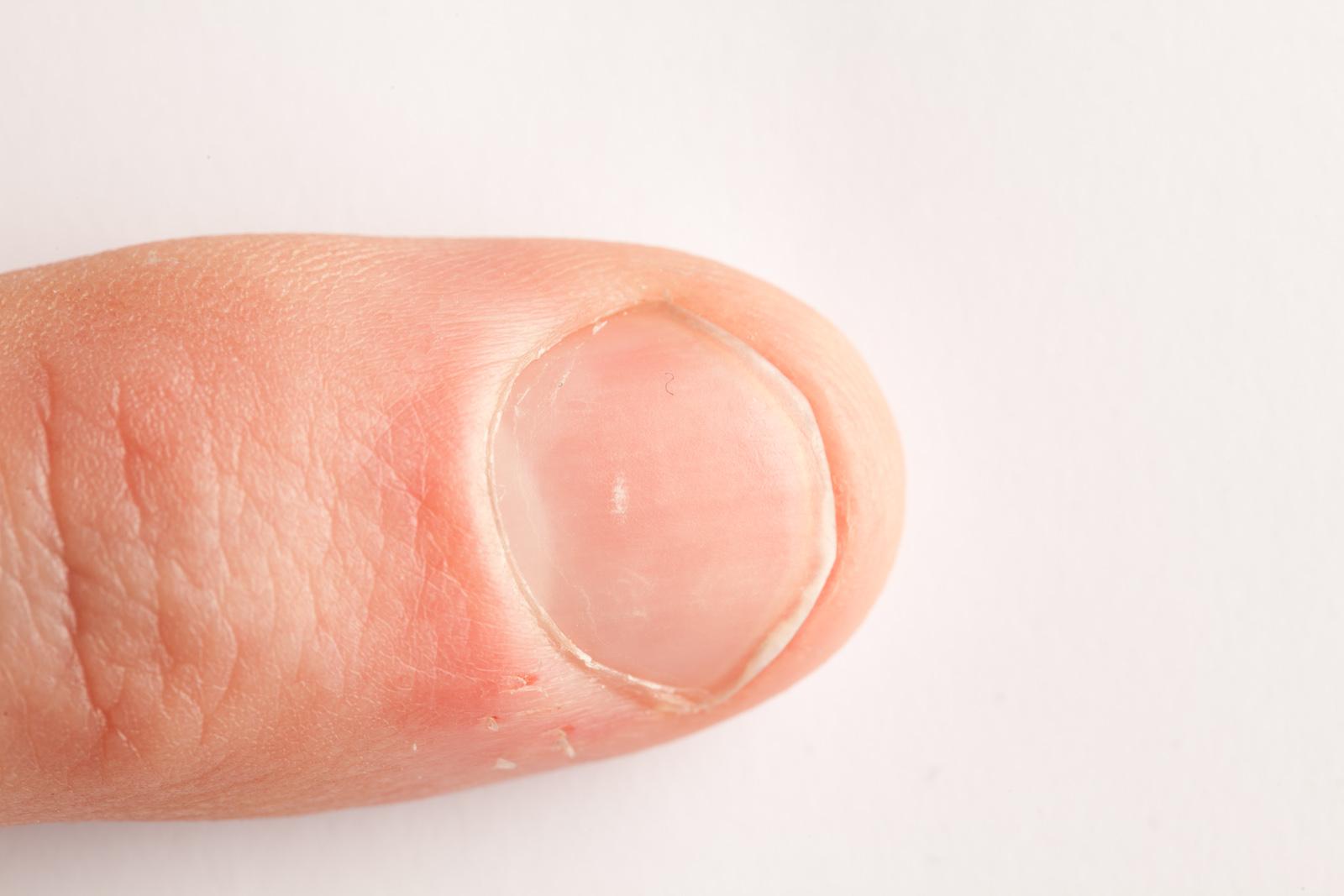 healthy_nail Object Detection Dataset by NAILPROJECT