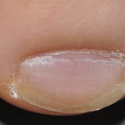 HEALTHY_NAILS Object Detection Dataset by NAILPROJECT