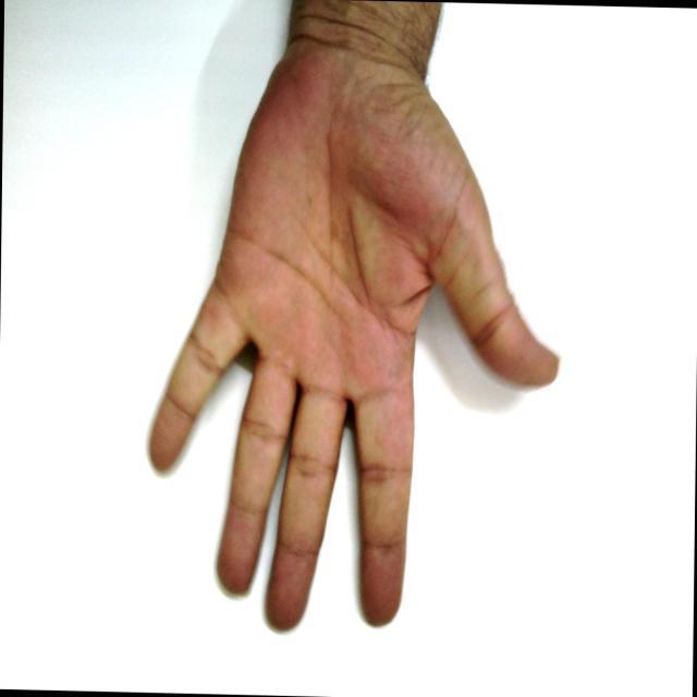 fingers_segmentation Instance Segmentation Dataset by imageclassification