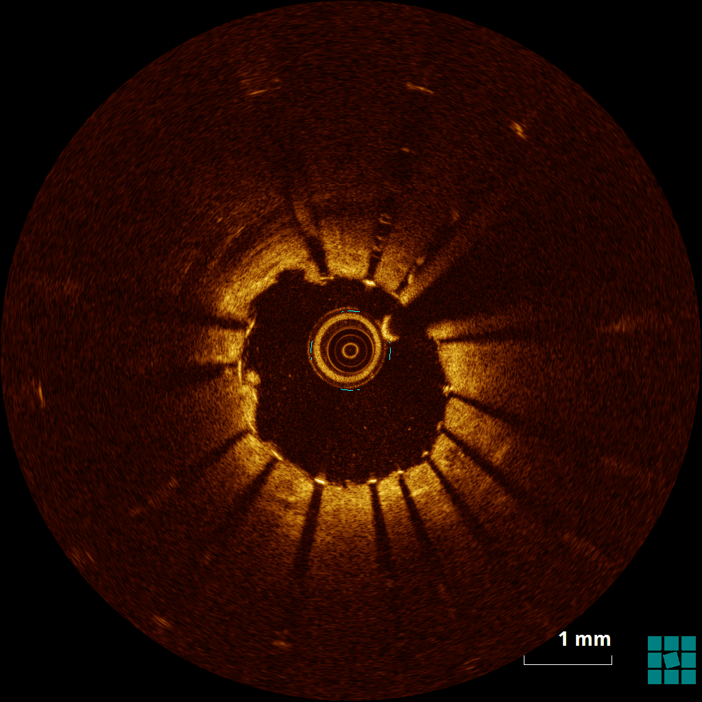 Cartesian Object Detection Dataset by RabahProjects