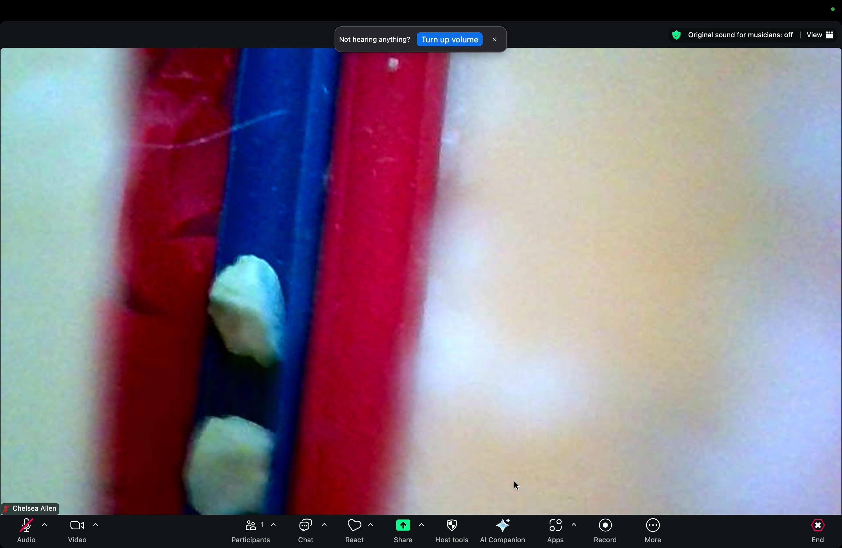 How to Use the DVT surgery model Instance Segmentation API