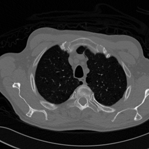 LUNA16_seg Instance Segmentation Model by LungCancerCT