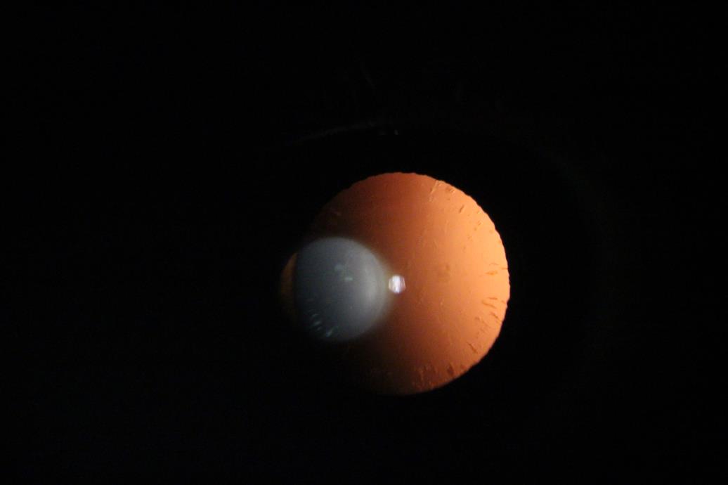 pupil_seg Instance Segmentation Model by mmnafar