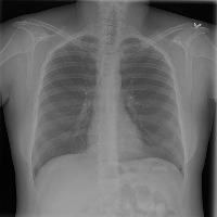 hadeel (hadeel-ezyti) - Roboflow Universe