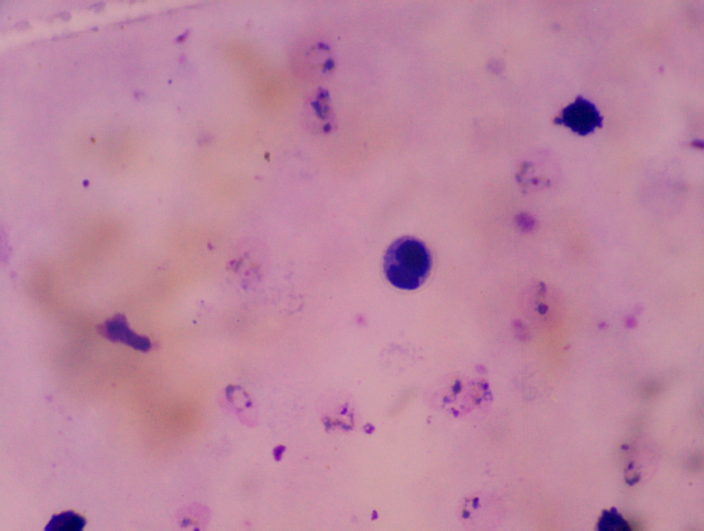 Malaria Object Detection Model By Malariaproject