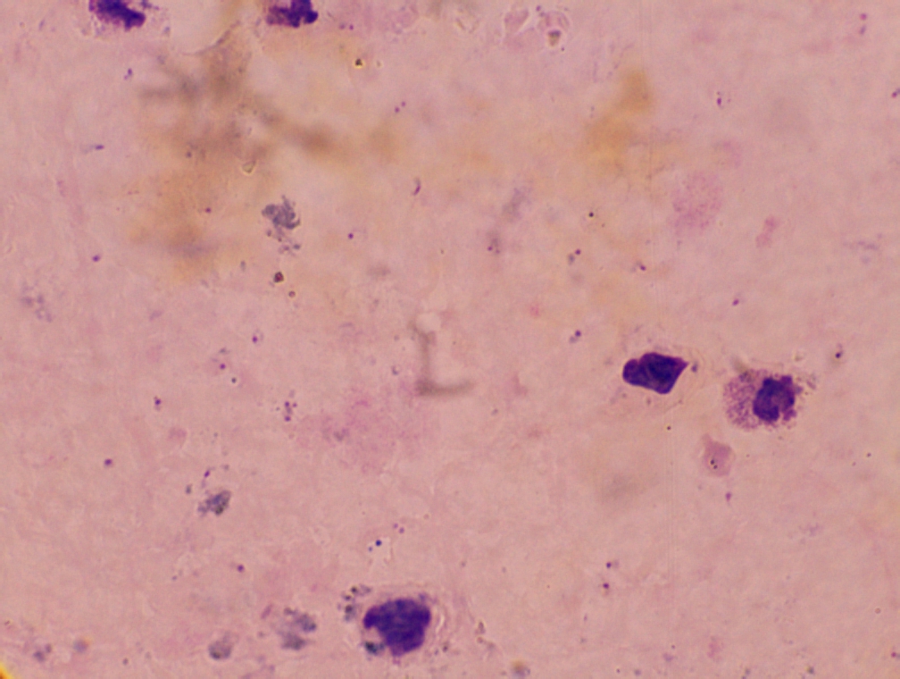 malaria_data Object Detection Dataset by Malariaproject