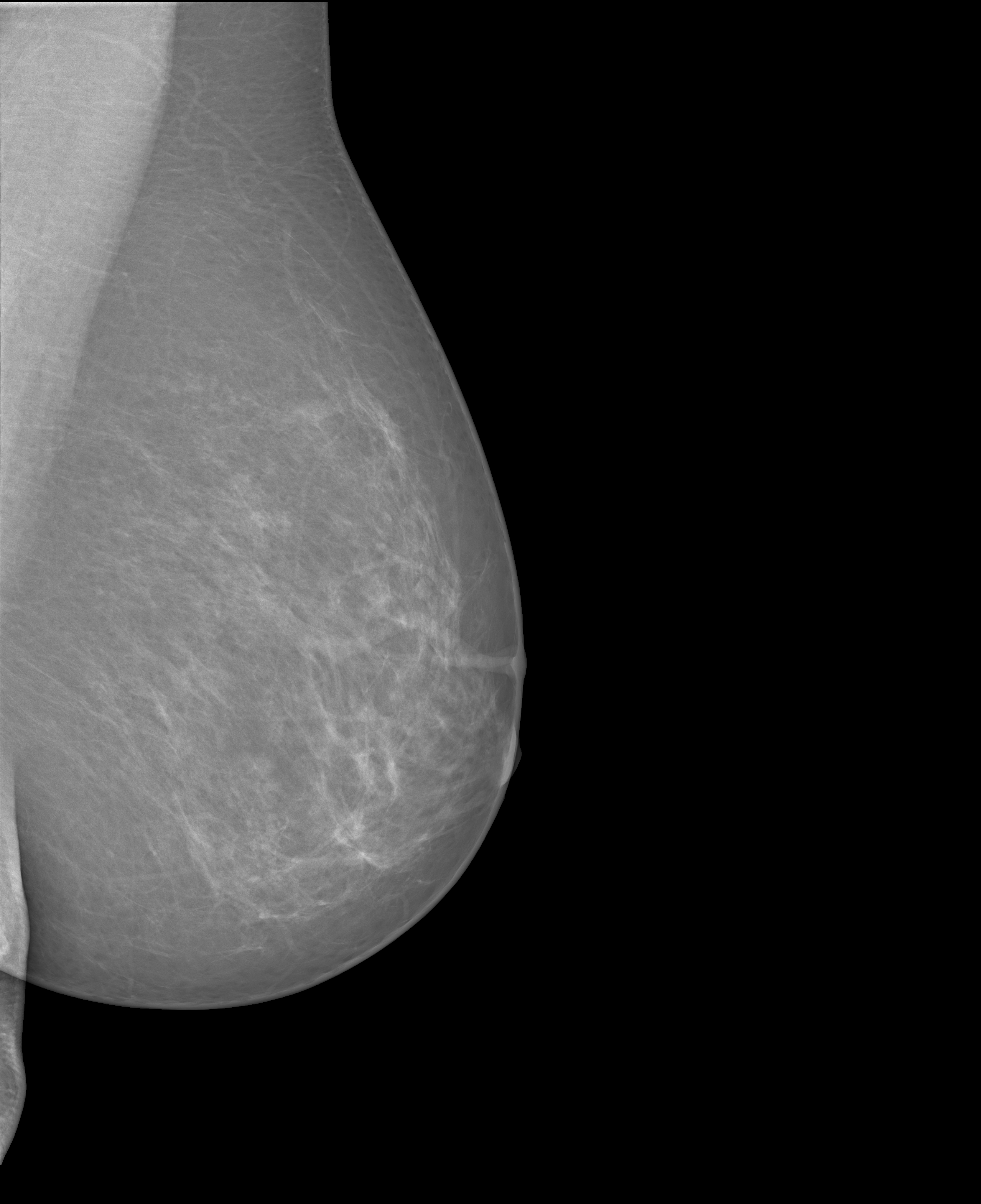 InBreast Pectoral Muscle Seg Instance Segmentation Dataset by caio ...