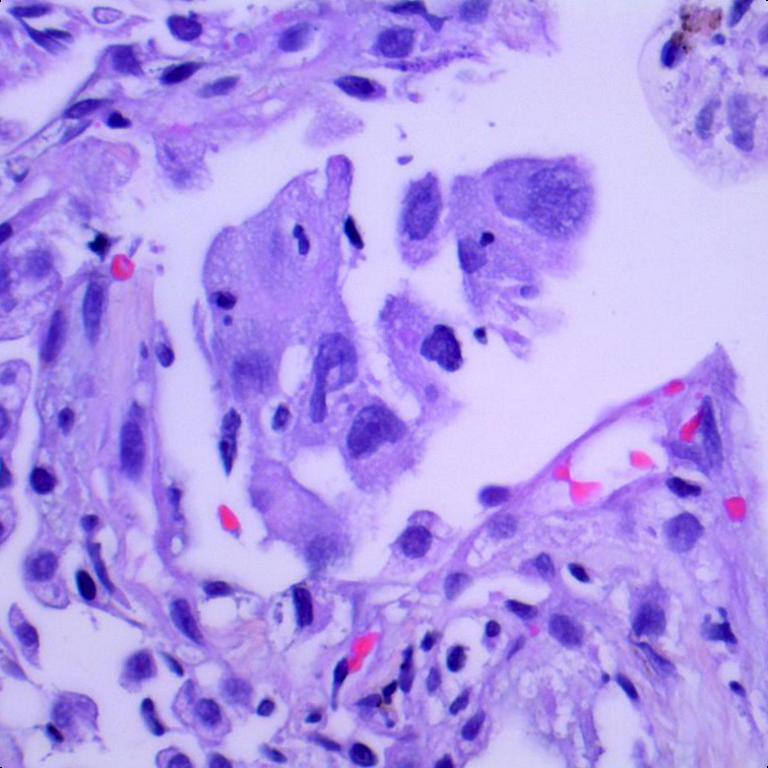 Histopathelogical Instance Segmentation Dataset and Pre-Trained Model by cell segmentation