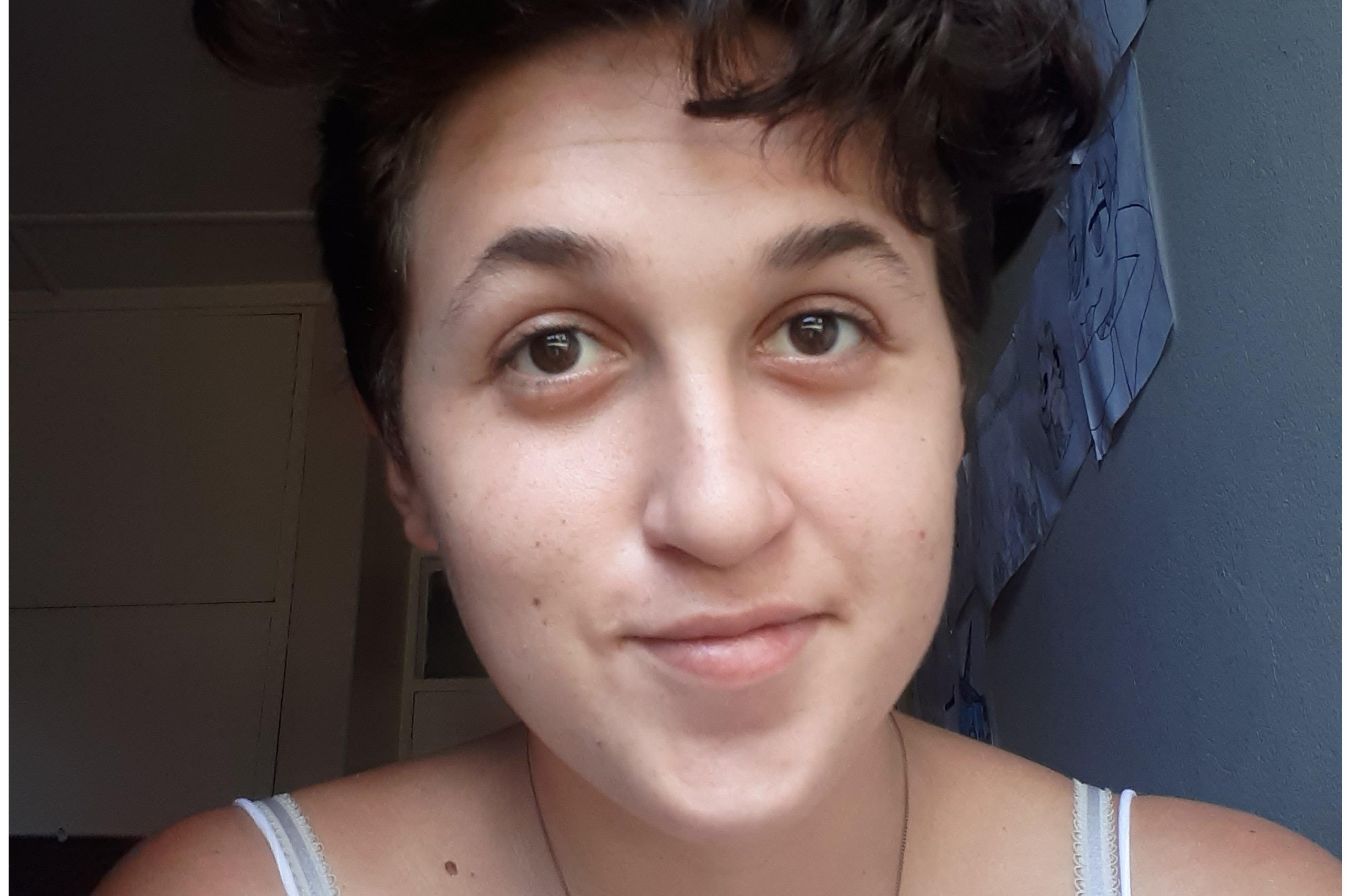 clf1 Classification Dataset by skinlesions