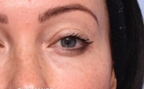 Bluesense (bluesense-pquzf) - Roboflow Universe