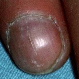 blabla Classification Dataset by AIIT nail competition