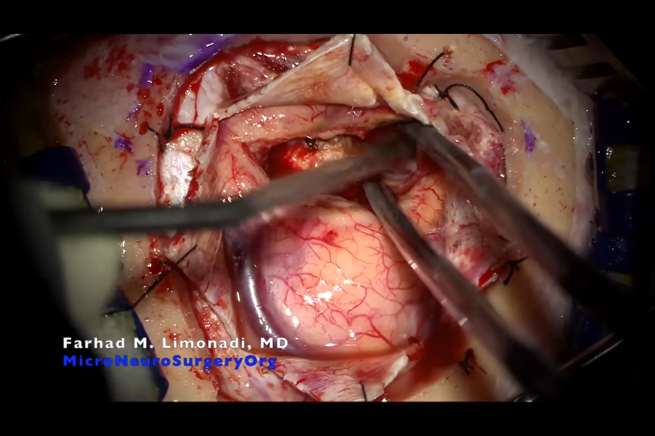 surgical dashboard - Roboflow Universe