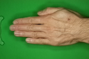 number-of-finger-Classification Classification Dataset and Pre-Trained ...