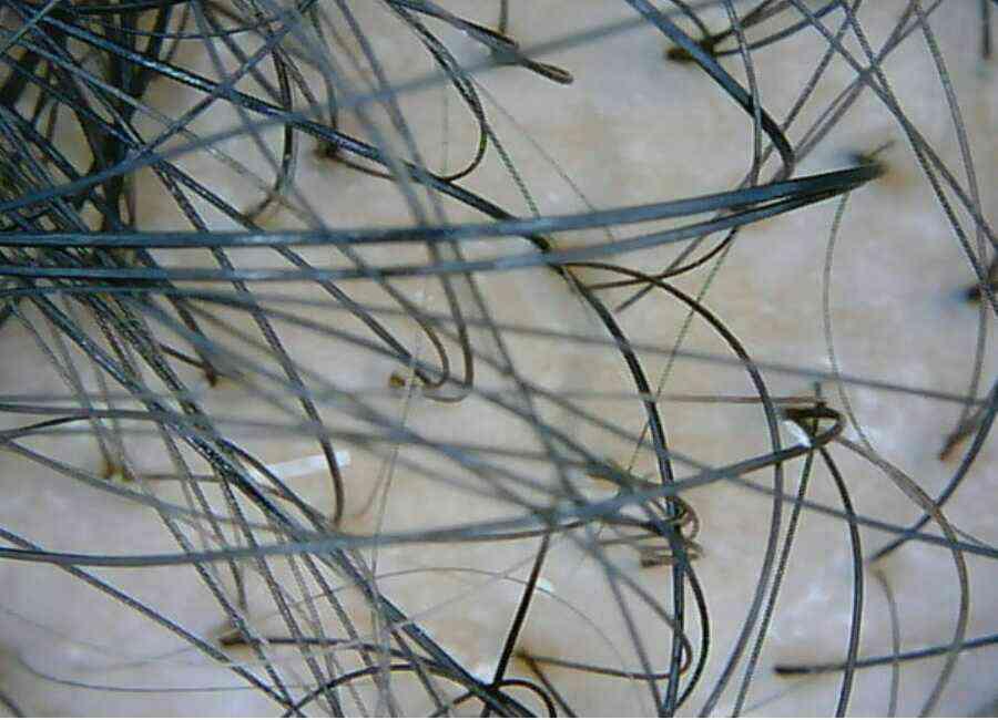 scalp-data Instance Segmentation Dataset by Major Project