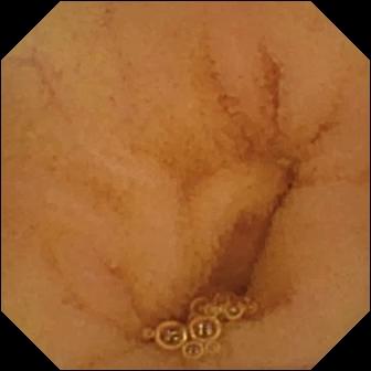 How to Use the wce_clean_train_2.0 Object Detection API