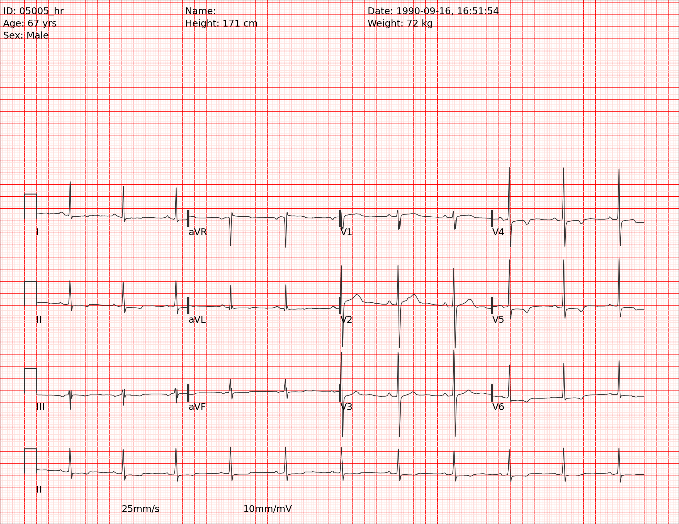 ECG Object Detection Dataset by alexandria university