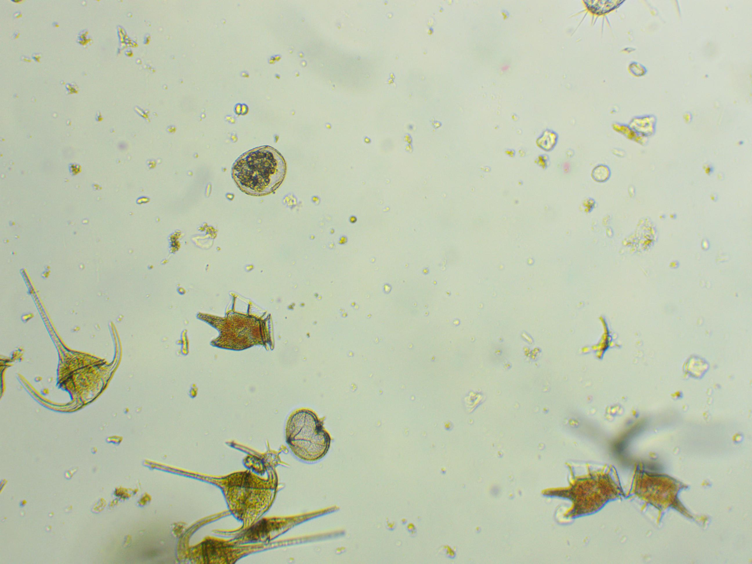 Phytoplankton Object Detection Model by Haavard Thorsnes