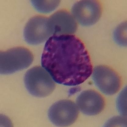 blood cell types detection Object Detection Dataset by obmslab