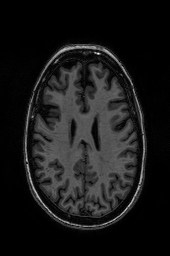 brain Classification Dataset by DEFISIENSI SAWIT