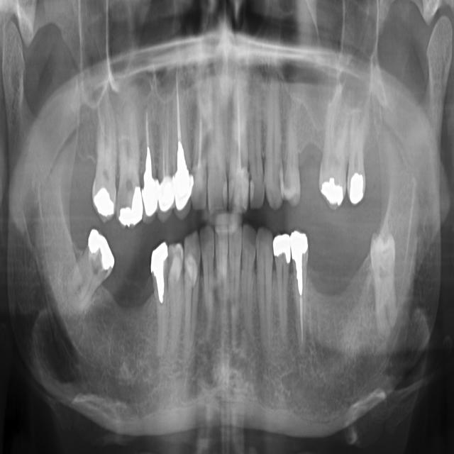 dry run Object Detection Model by Gauraw Jumnake