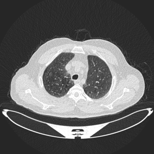 Lung Classification Classification Dataset By College