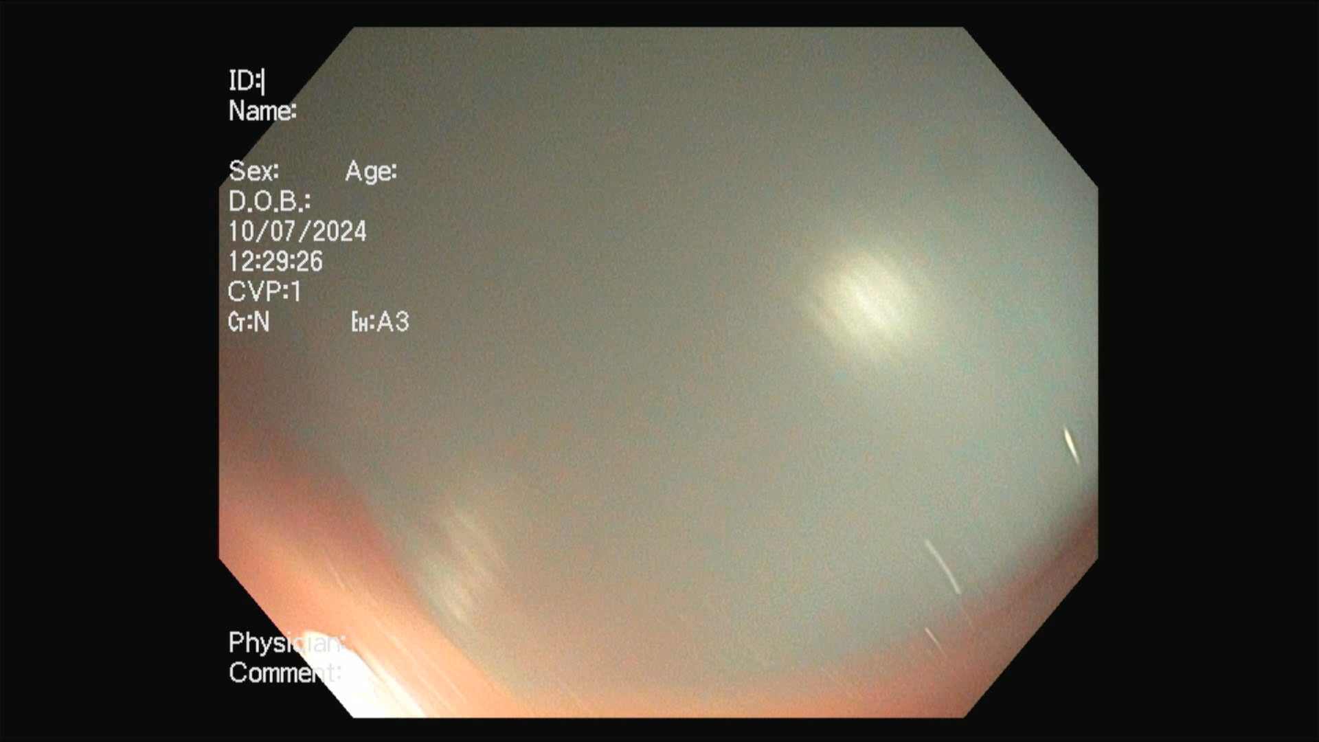 Colonoscopy Training Model Classification Model by ColonoscopyModel