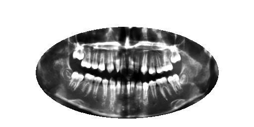 Dentalai I4clz Fsod Fsuo Object Detection Dataset By Roboflow 100 Vl Fsod