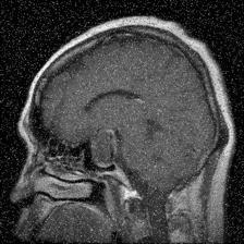 crystal-clean-brain-tumors-mri-dataset-hzb2f-fsod-plsq Object Detection ...