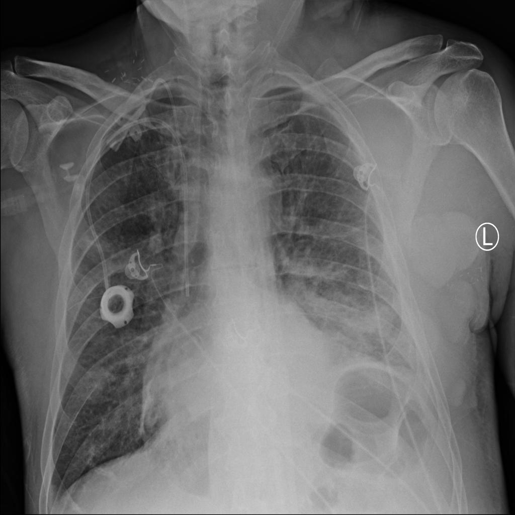Nih Xray Itazg Fsod Xeoi Object Detection Dataset By Roboflow 100 Vl Fsod
