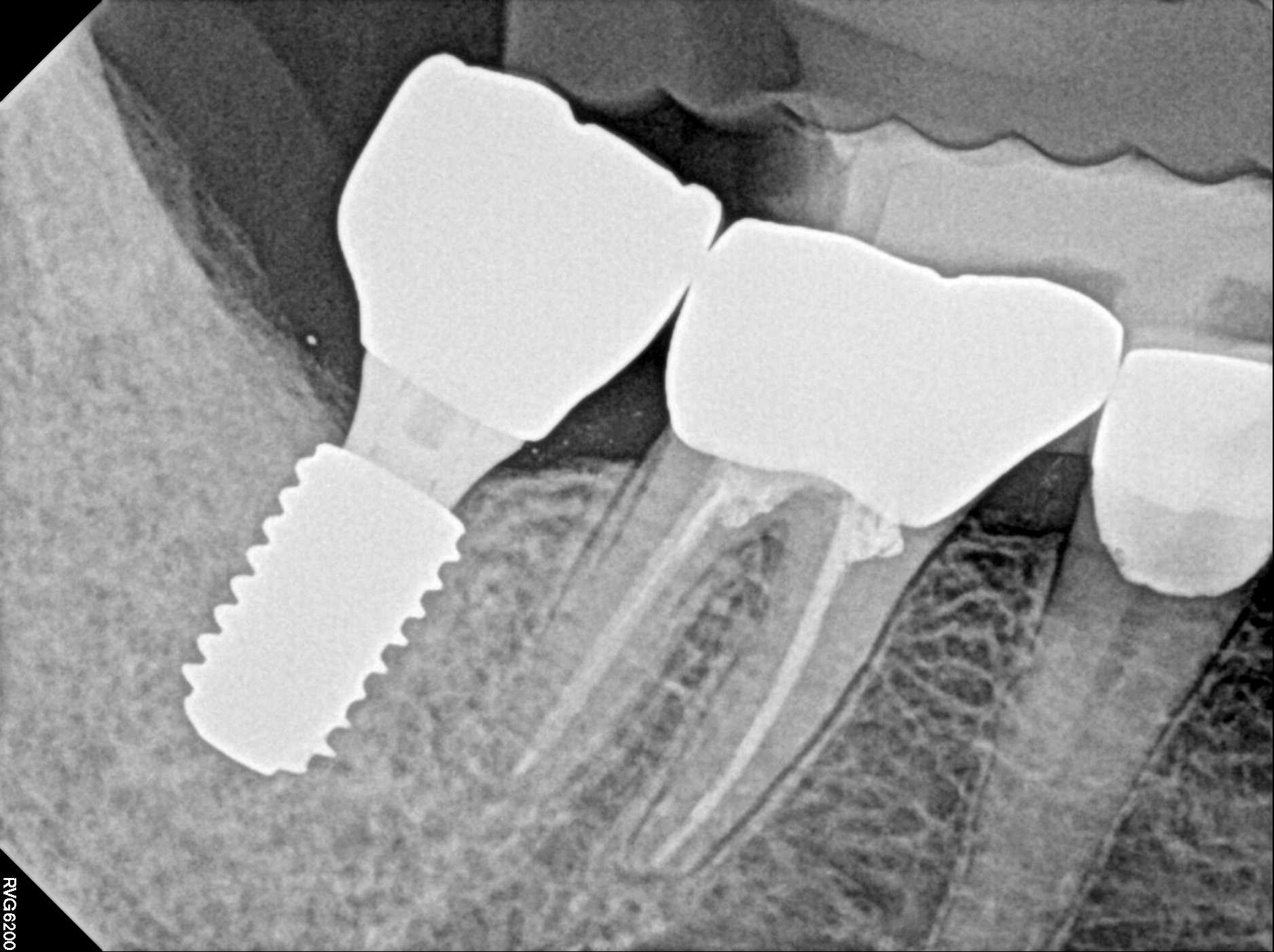 quve - Roboflow Universe