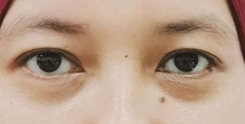 IRIS Object Detection Dataset by akmalasraf