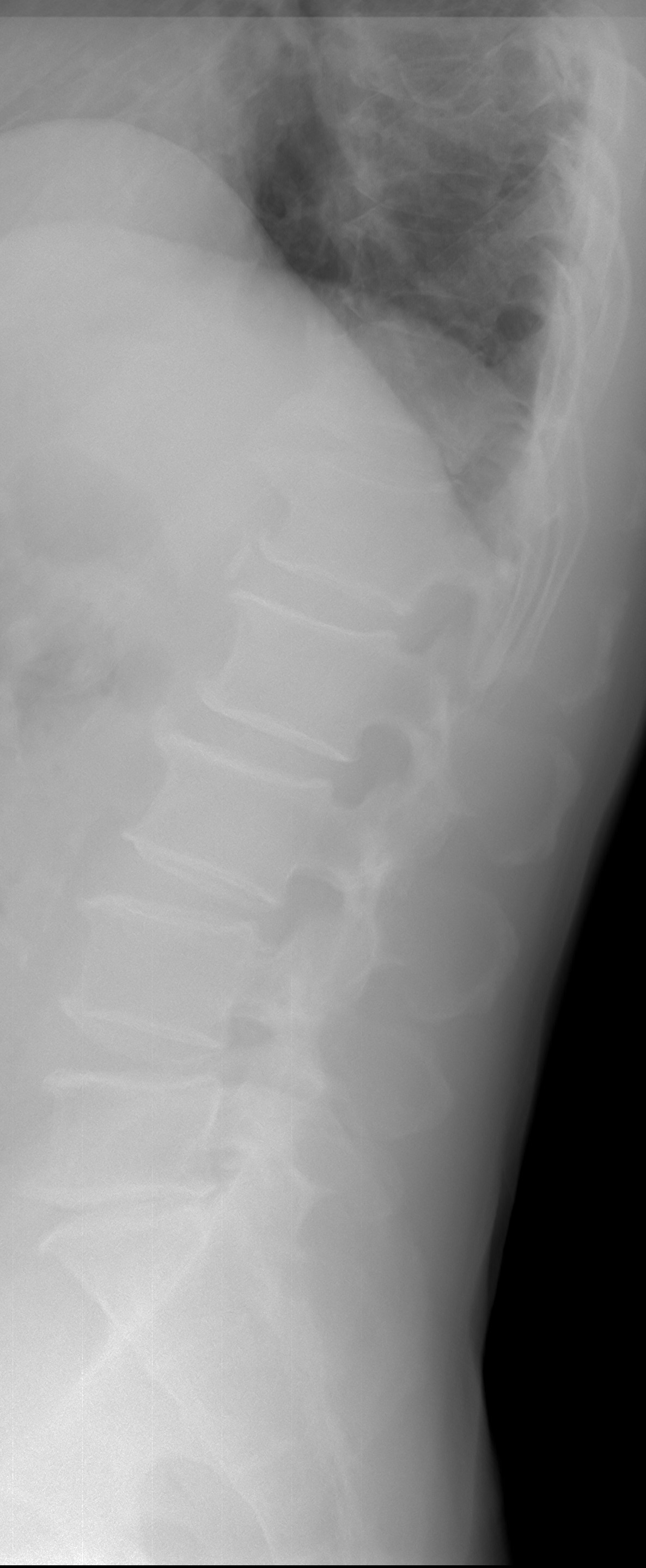 Xray Object Detection Dataset By Ok