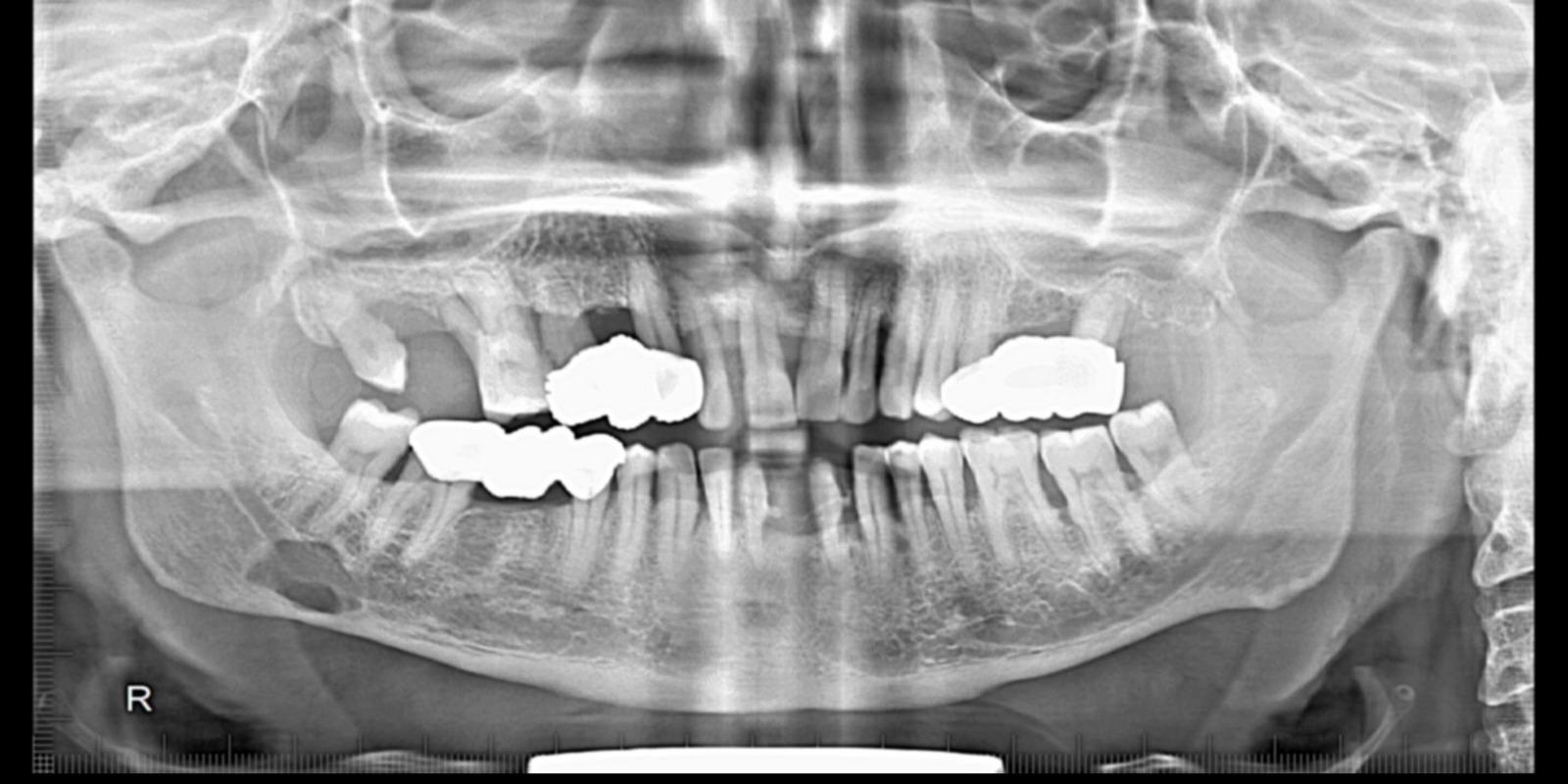 Tooth Instance Segmentation Dataset by tooth