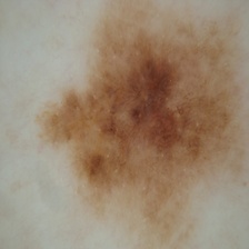 skin Object Detection Model by machine train