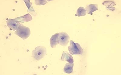 Cell Classification Object Detection Dataset and Pre-Trained Model by School