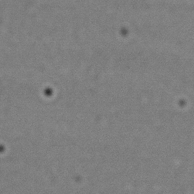 Protein iSCAT - Roboflow Universe