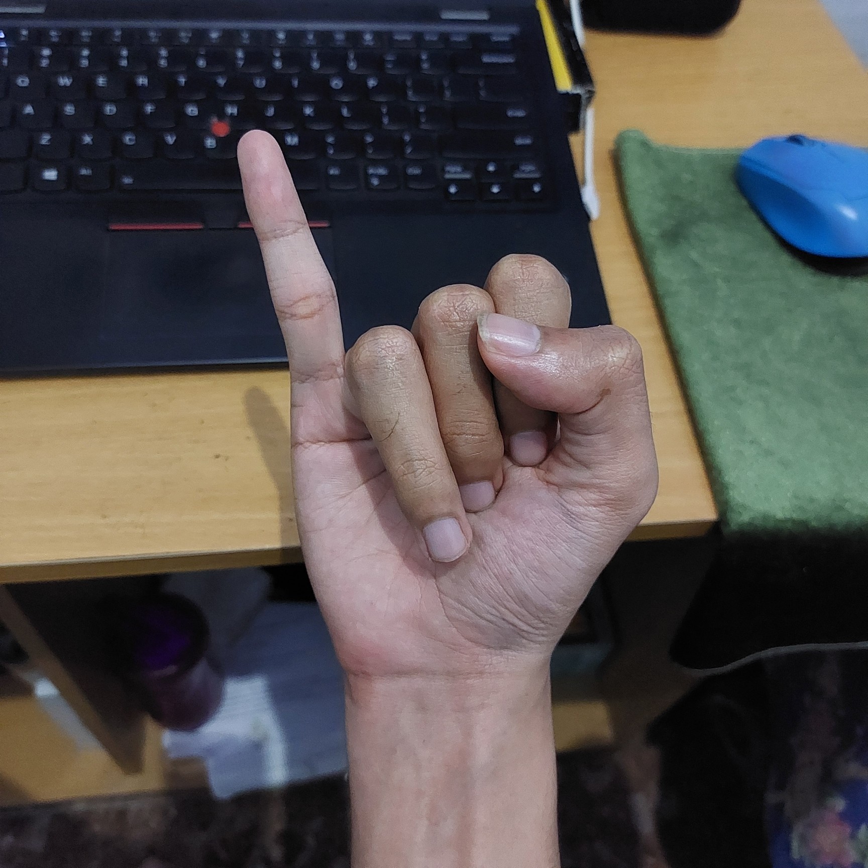 isyarat-abjad-sibi Object Detection Dataset and Pre-Trained Model by ... isyarat-abjad-sibi Object Detection Dataset and Pre-Trained Model by ...