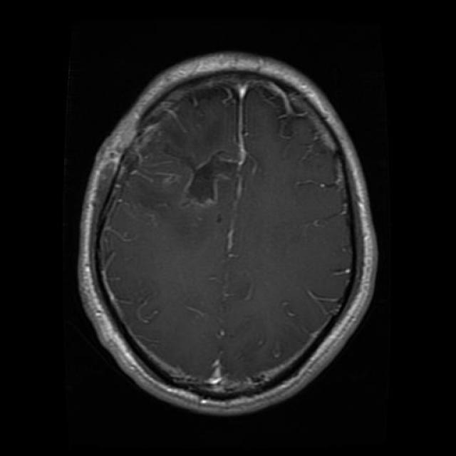 Liver vs. Brain MRI Classification Model by Kero