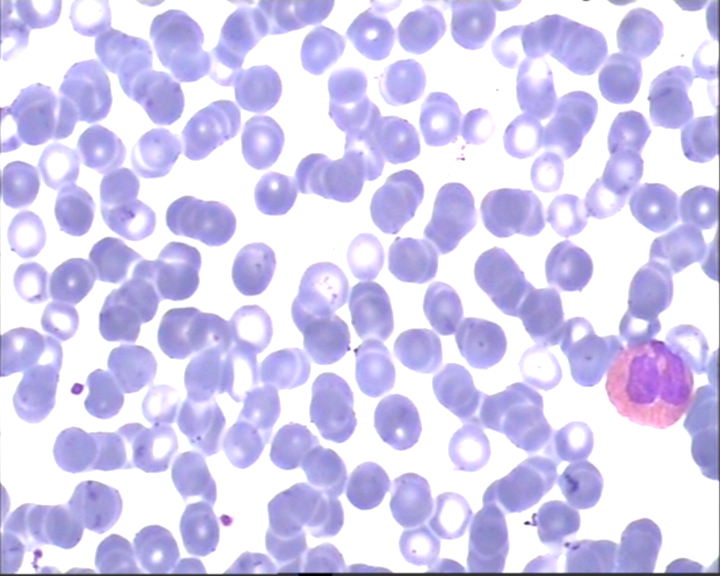 labeled_WBC Object Detection Dataset by myworkspace