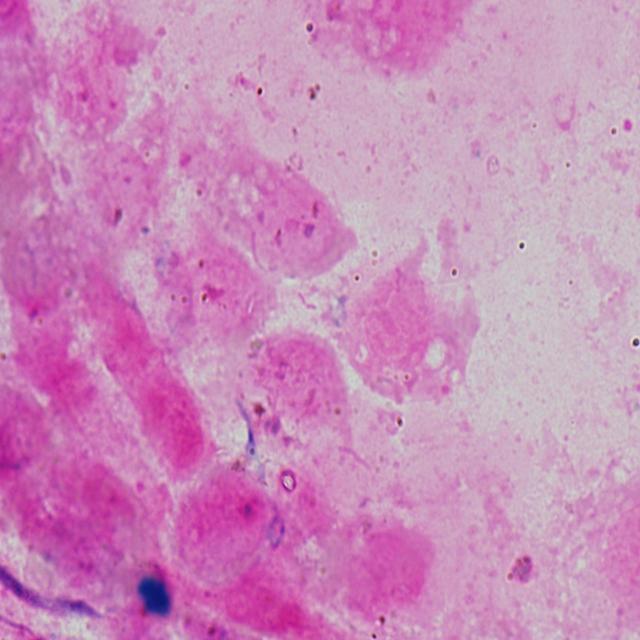 5bacteria Object Detection Dataset By Bacteria