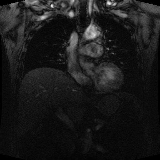 Yu Lab - Roboflow Universe