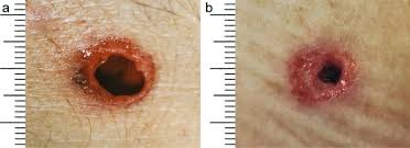 scoder - Roboflow Universe