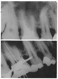 vasudha_iop_bbox Object Detection Dataset by roboflowbboxtoseg