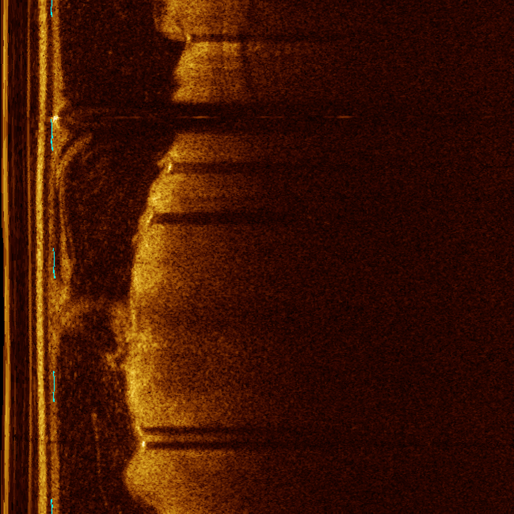 Anhlamfoldernay Trung F306 Object Detection Dataset V1 2022 09 13 4