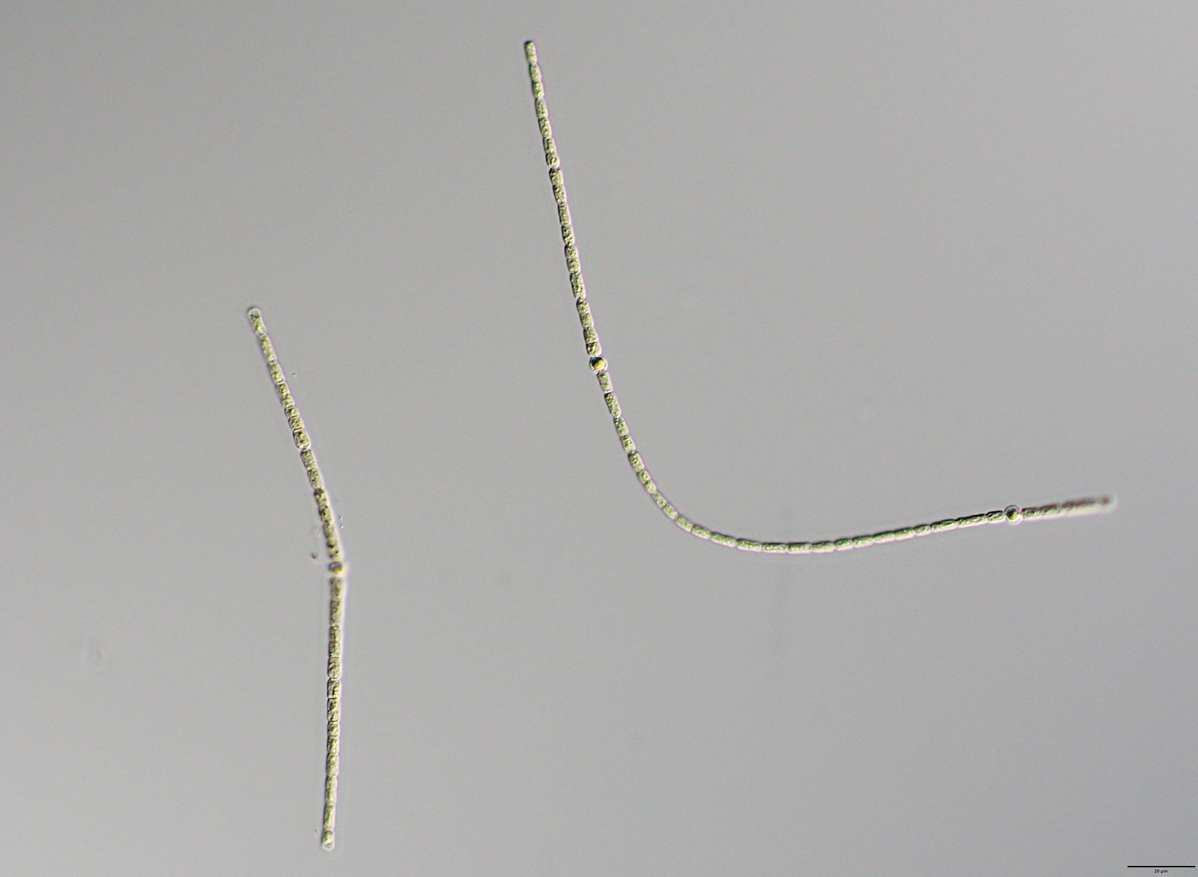 Cyanobacteria Dataset (Glenn) Object Detection Model by AI Microscopy