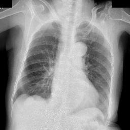 How to Use the lung Object Detection API