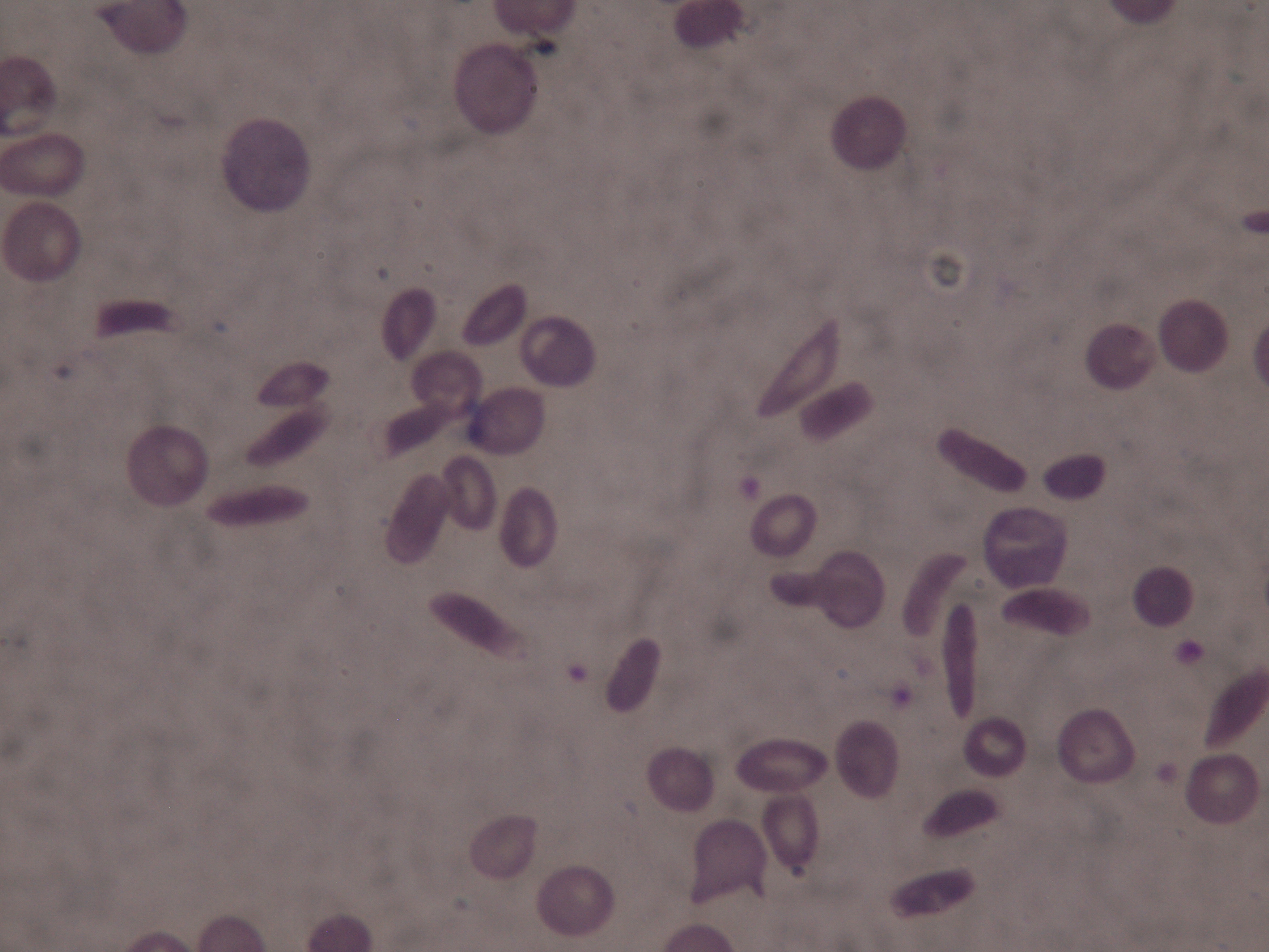 sickle-cell Object Detection Dataset and Pre-Trained Model by sicklecell