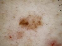 Ranim Aloui (ranim-aloui-g4xhd) - Roboflow Universe