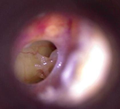 ear Classification Dataset and Pre-Trained Model by School