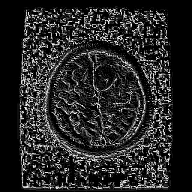 Brain tumor Object Detection Model by project-oftnd